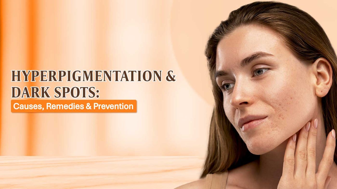 Hyperpigmentation & Dark Spots: Causes, Remedies & Prevention