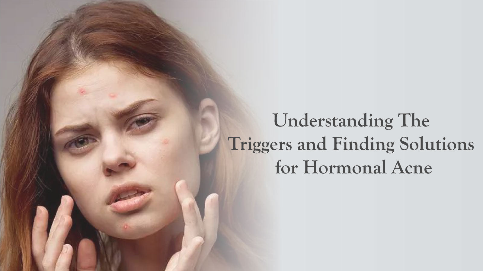Understanding The Triggers and Finding Solutions for Hormonal Acne