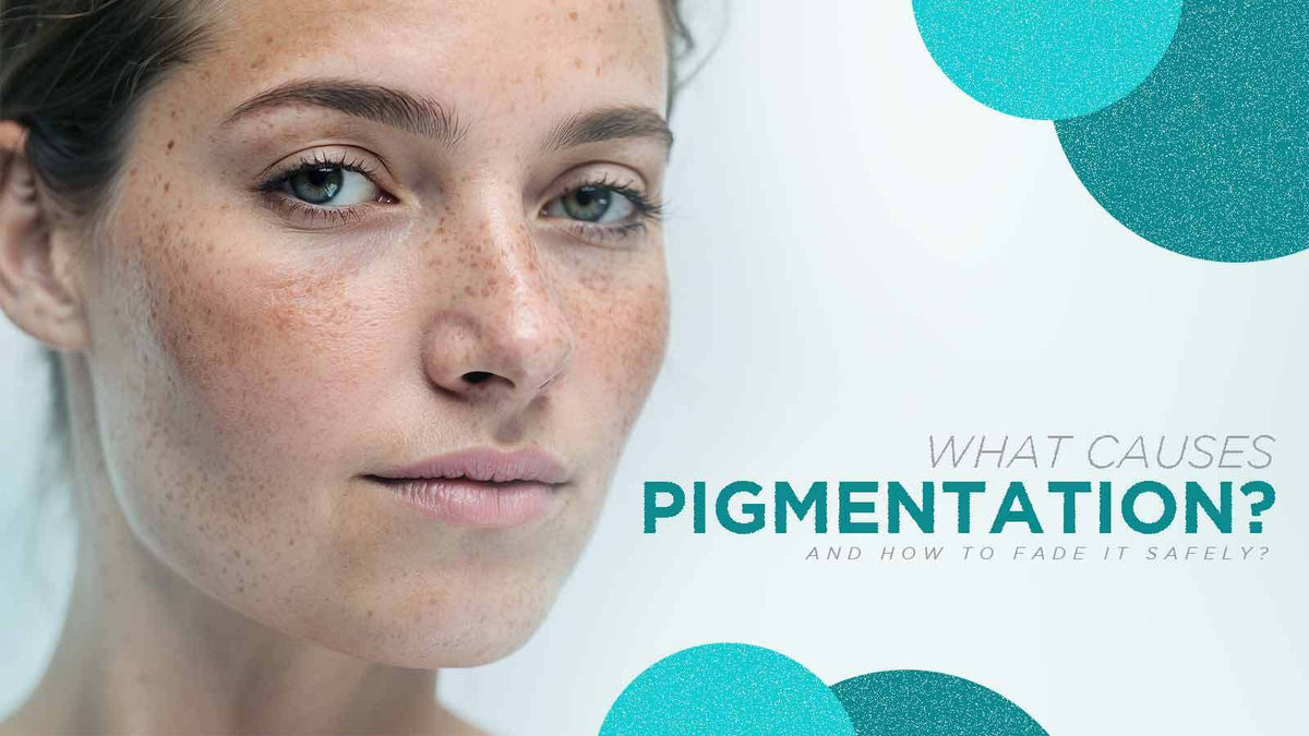 What Causes Pigmentation – and How to Fade It Safely